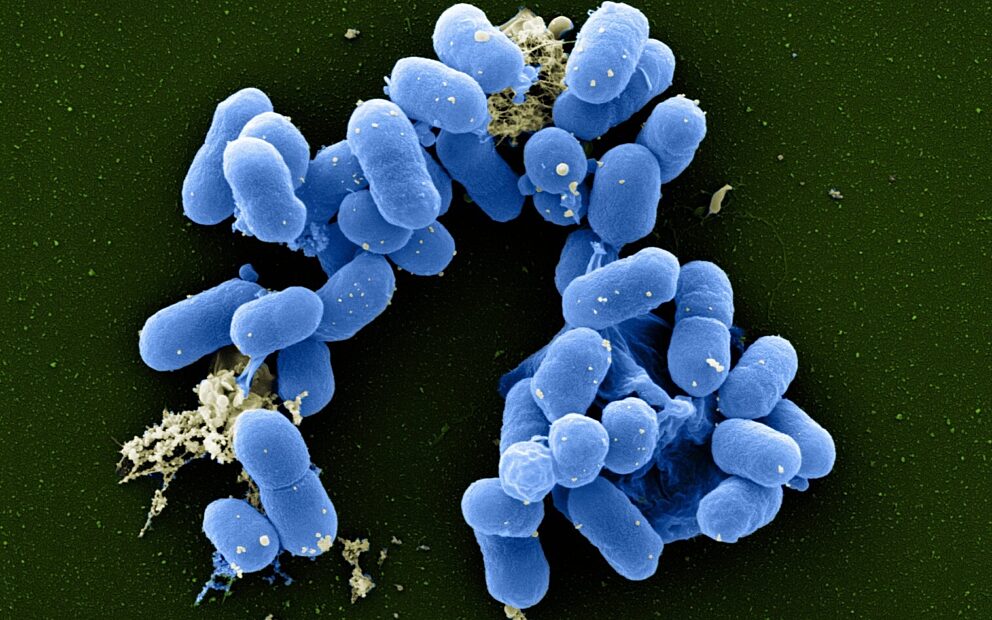 Unterfranken: Vereinzelte EHEC-Erkrankungen in… | Radio Gong Würzburg